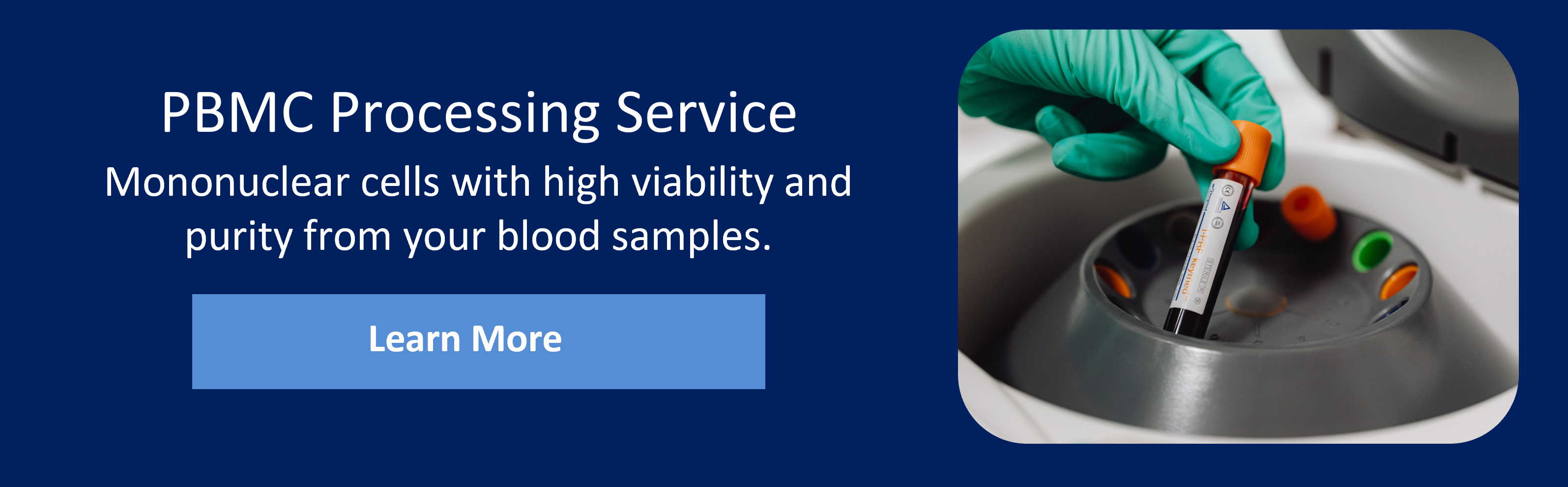 What are PBMCs? Everything you need to know about Peripheral Blood Mononuclear Cells